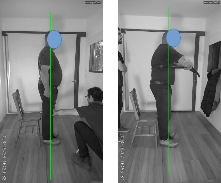 Posture assessment: Loneranger80 | Good Posture Studio